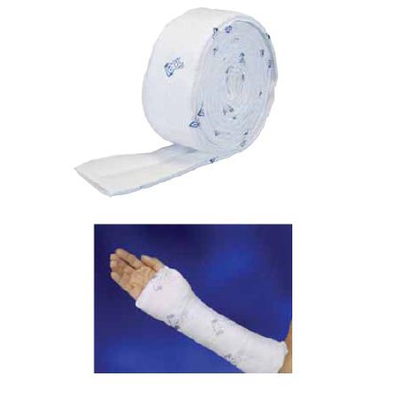 OCL Padded Foot Plaster Splint Roll, 6 Inch x 20 Feet - Each
