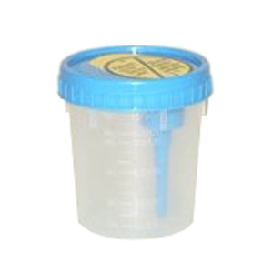 Vacutainer Urine Specimen Container with Integrated Transfer Device ...